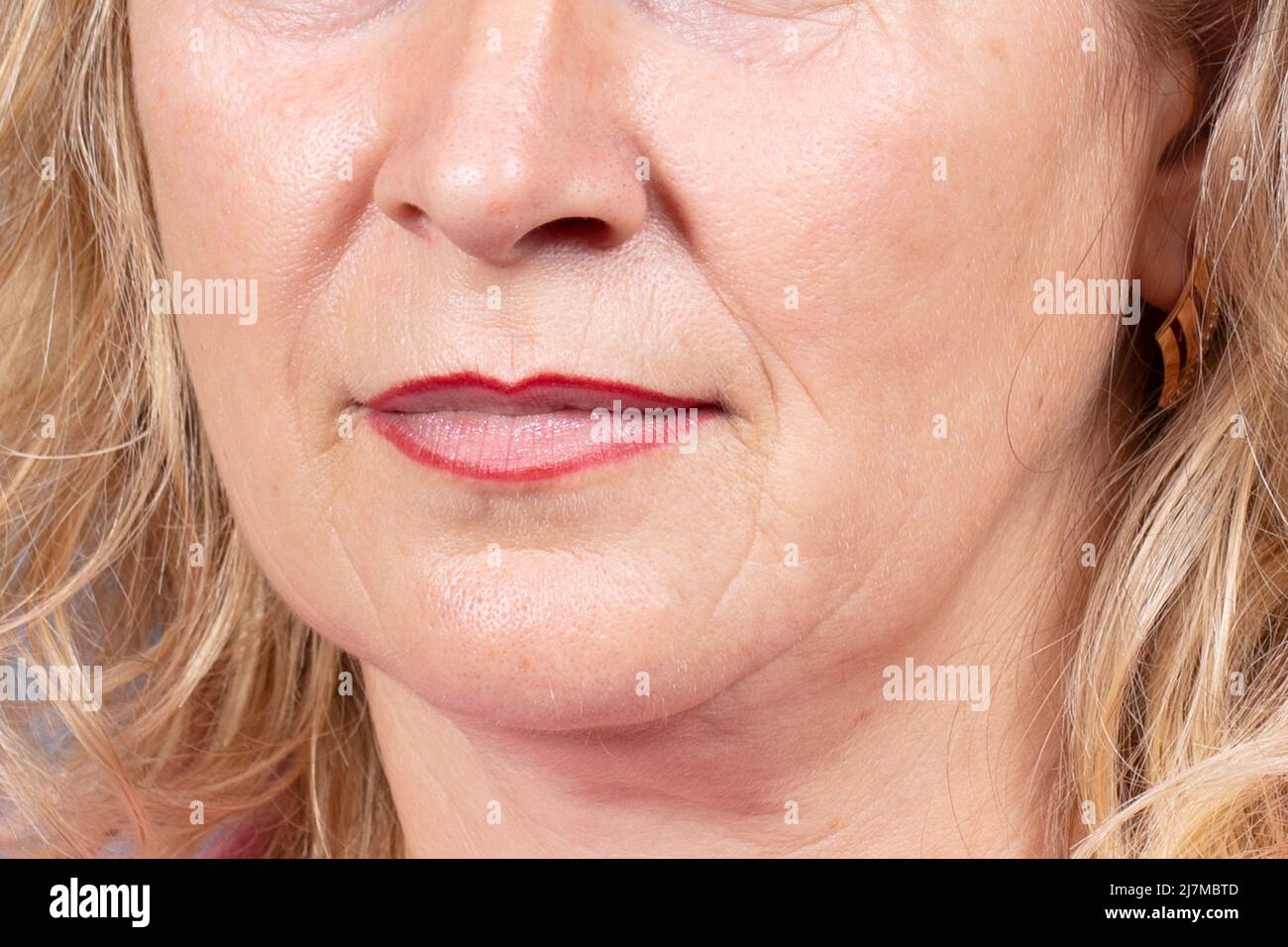 The lower part of the face and neck of an elderly woman with signs of ...