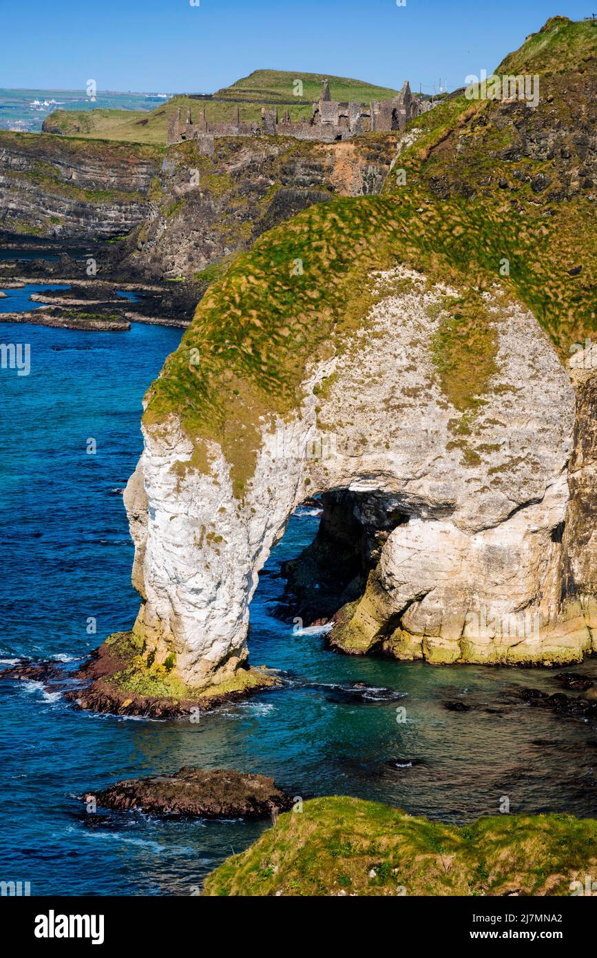 Dunluce ireland arch hi-res stock photography and images - Alamy