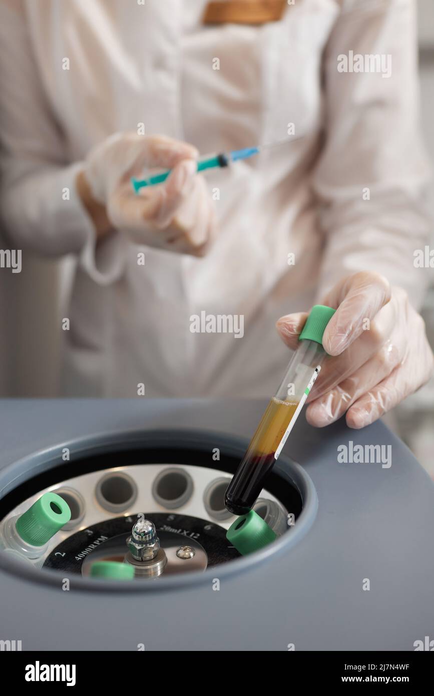 Platelet-Rich plasma preparation. Plasma in syringe. Centrifuge Stock ...