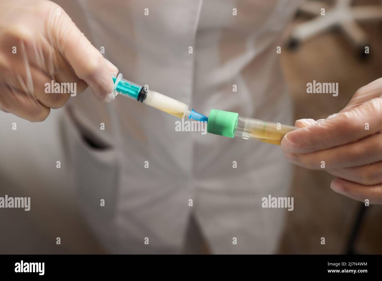 Platelet-Rich plasma preparation. Plasma in syringe. Centrifuge Stock ...