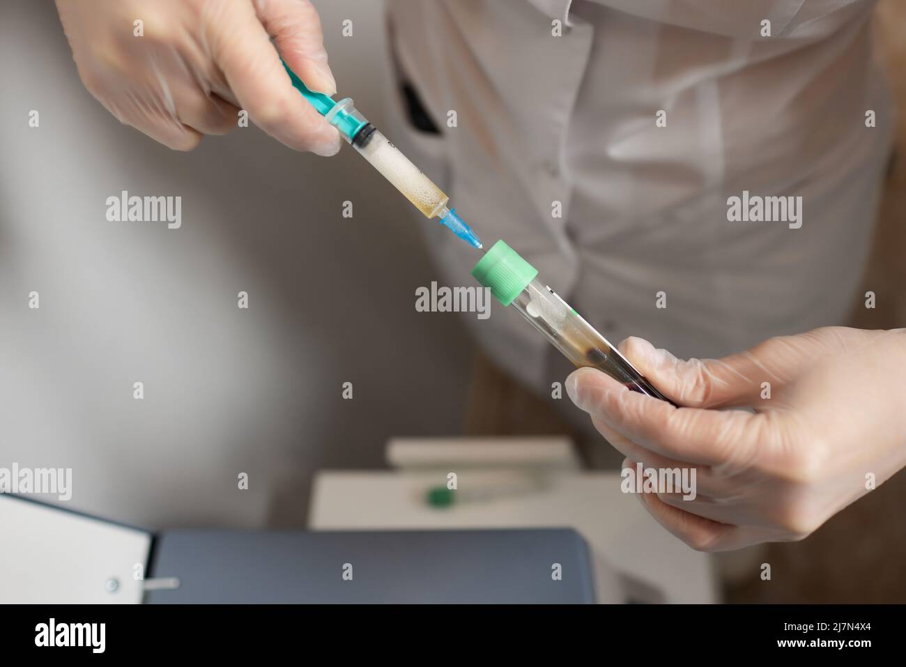 Platelet-Rich plasma preparation. Plasma in syringe. Centrifuge Stock ...