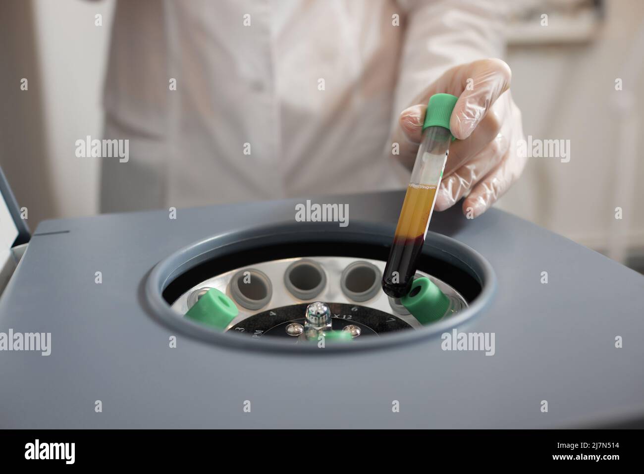 Platelet-Rich plasma preparation. Plasma in syringe. Centrifuge Stock ...