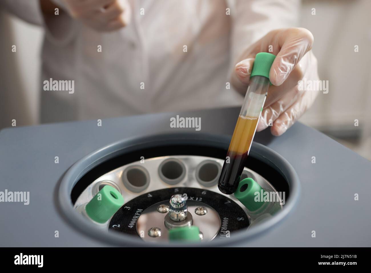Platelet-Rich plasma preparation. Plasma in syringe. Centrifuge Stock Photo - Alamy