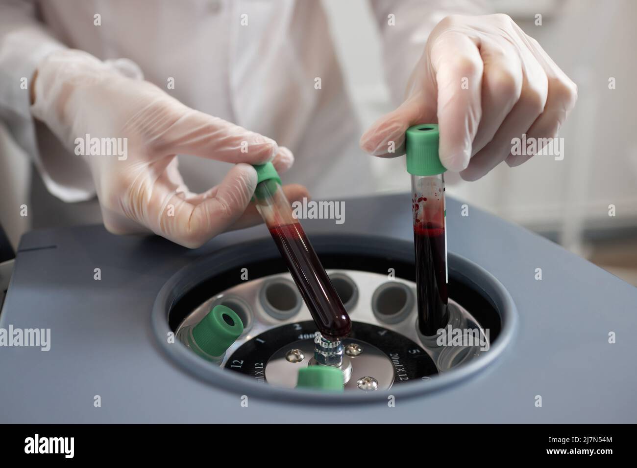 Platelet-Rich plasma preparation. Plasma in syringe. Centrifuge Stock ...