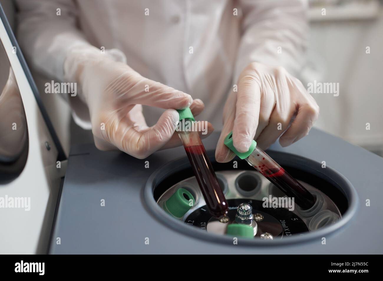 Platelet-Rich plasma preparation. Plasma in syringe. Centrifuge Stock ...