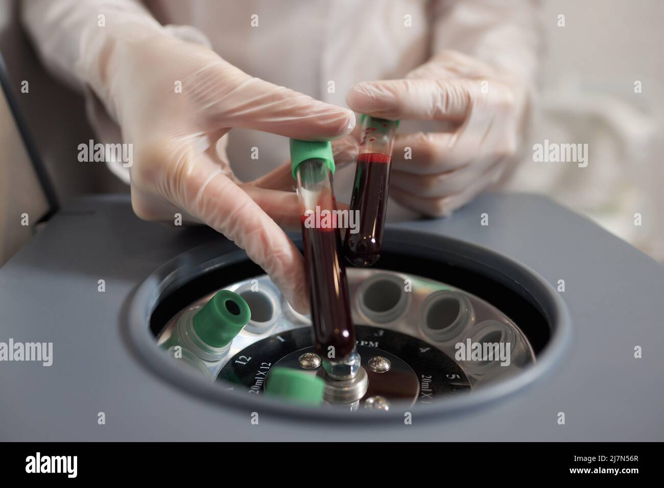 Platelet-Rich plasma preparation. Plasma in syringe. Centrifuge Stock ...