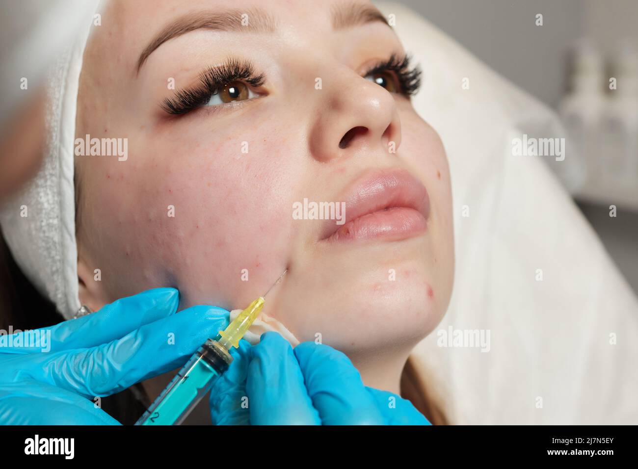 Syringe with a patient's blood plasma in a cosmetologist's hand for a ...