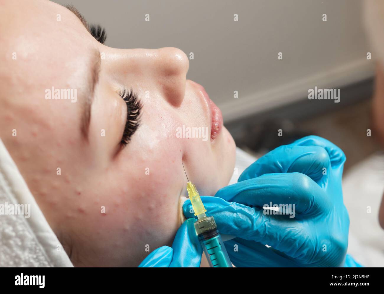 Syringe with a patient's blood plasma in a cosmetologist's hand for a ...