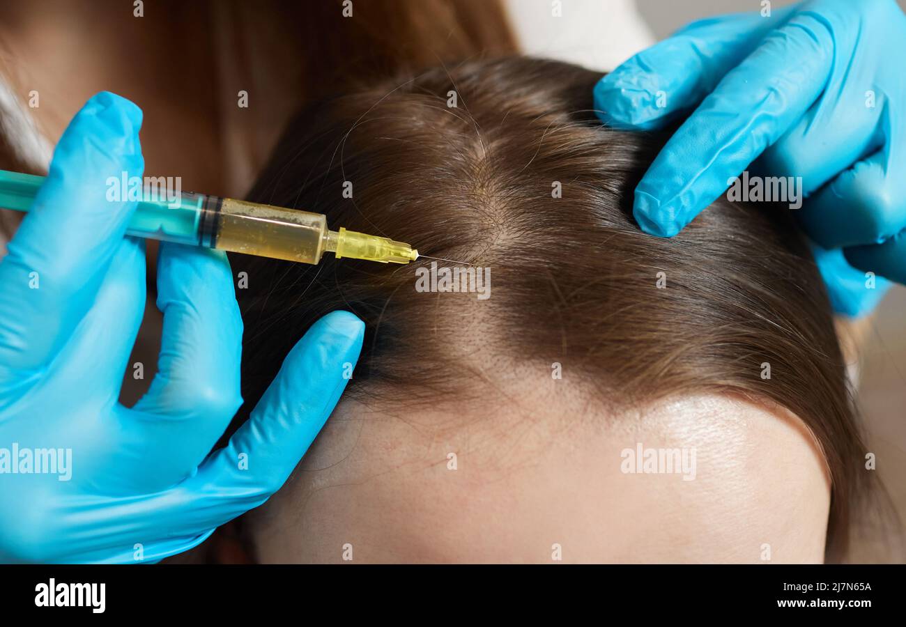 Plasma treatment, plasmolifting or PRP method point the introduction of ...