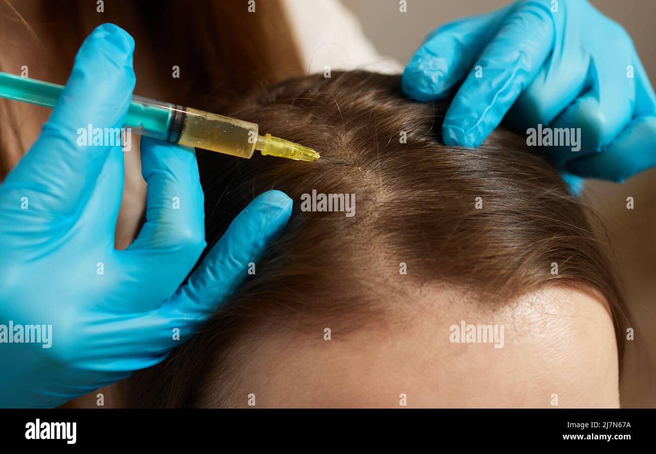 Plasma treatment, plasmolifting or PRP method point the introduction of ...