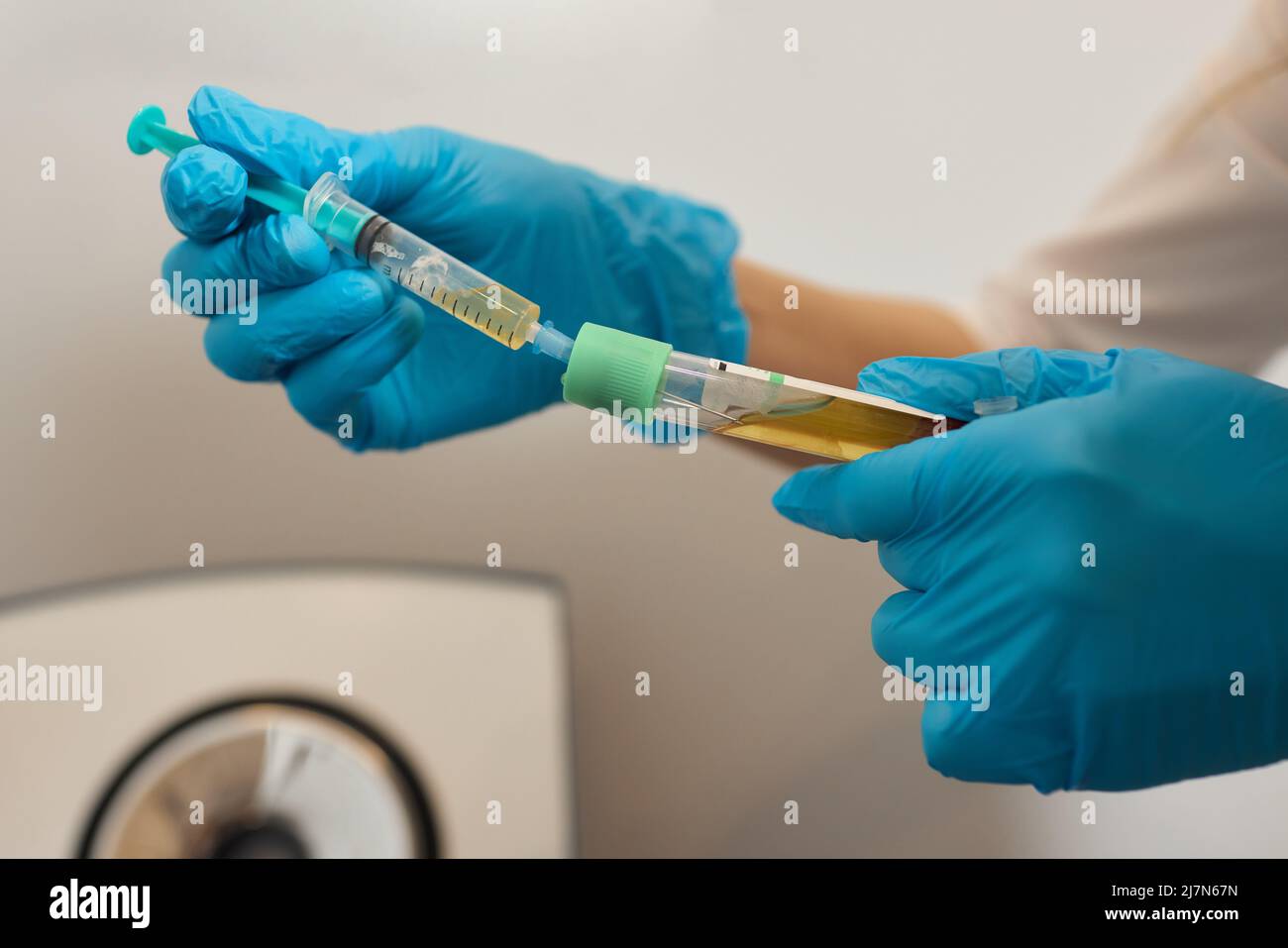 Platelet-Rich plasma preparation. Plasma in syringe. Centrifuge Stock ...