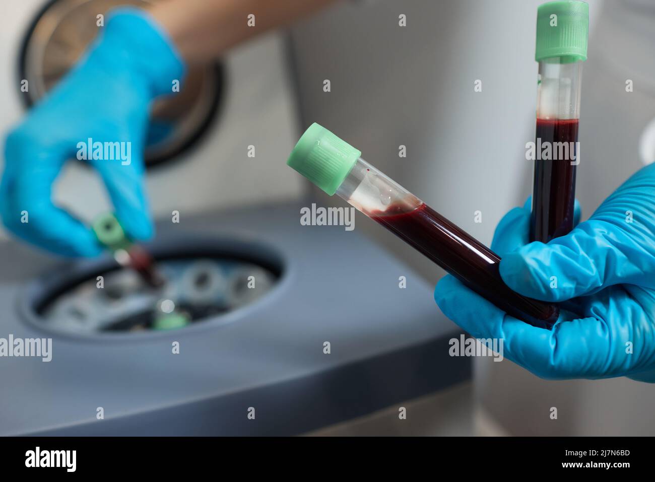 Platelet-Rich plasma preparation. Plasma in syringe. Centrifuge Stock ...