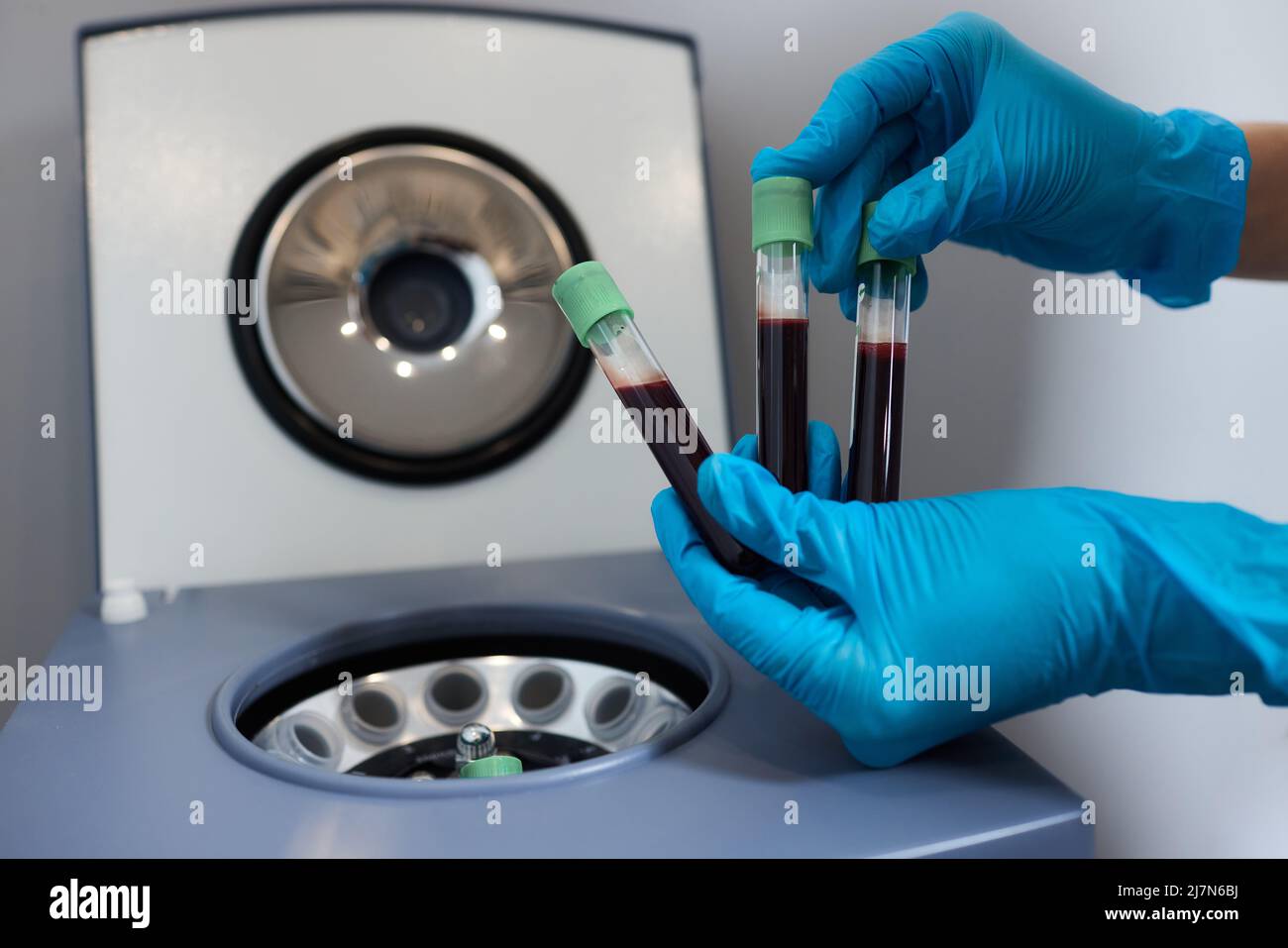 Platelet-Rich plasma preparation. Plasma in syringe. Centrifuge Stock ...