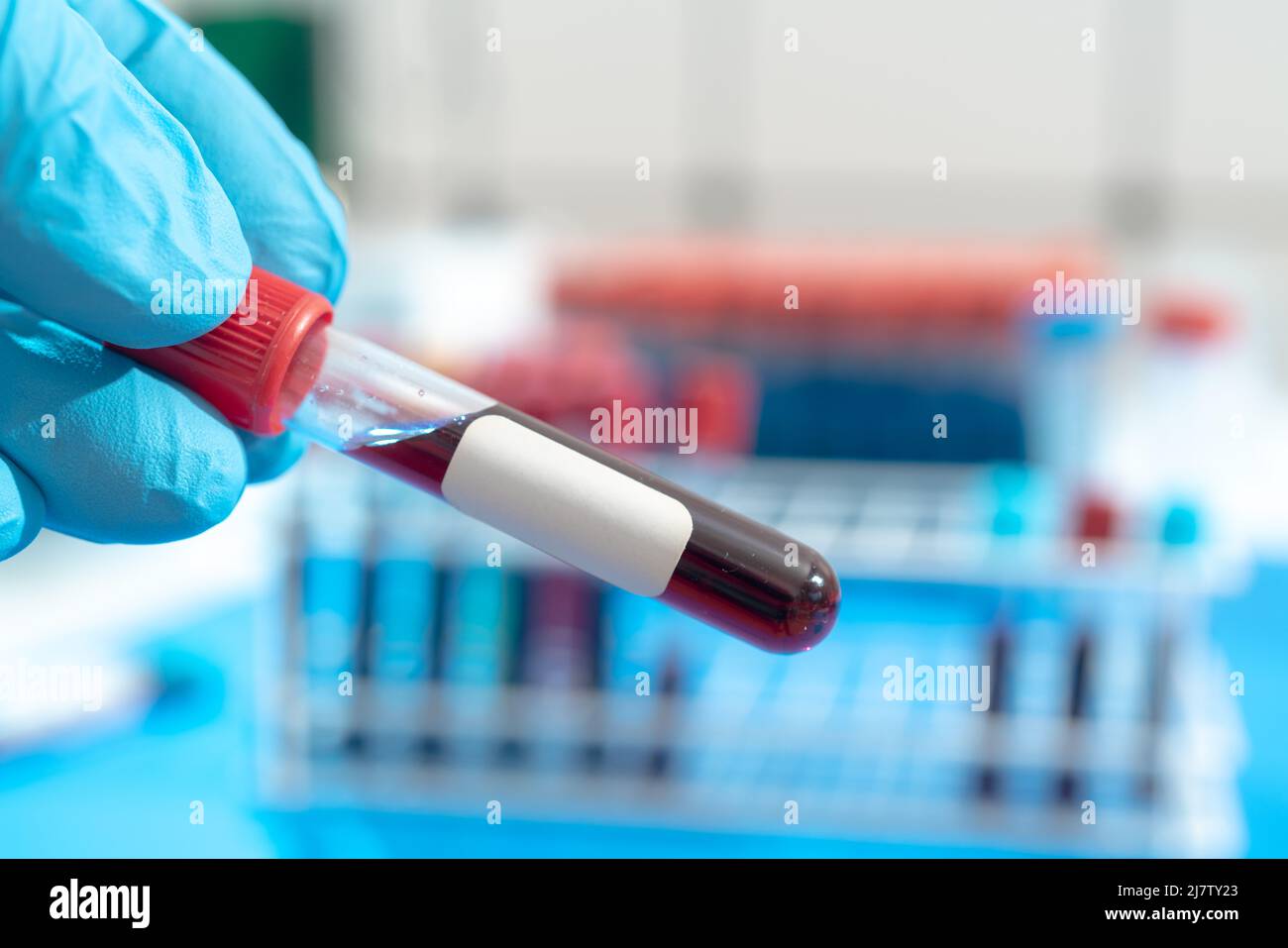 Test tube with empty label to biological sample for medical laboratory ...