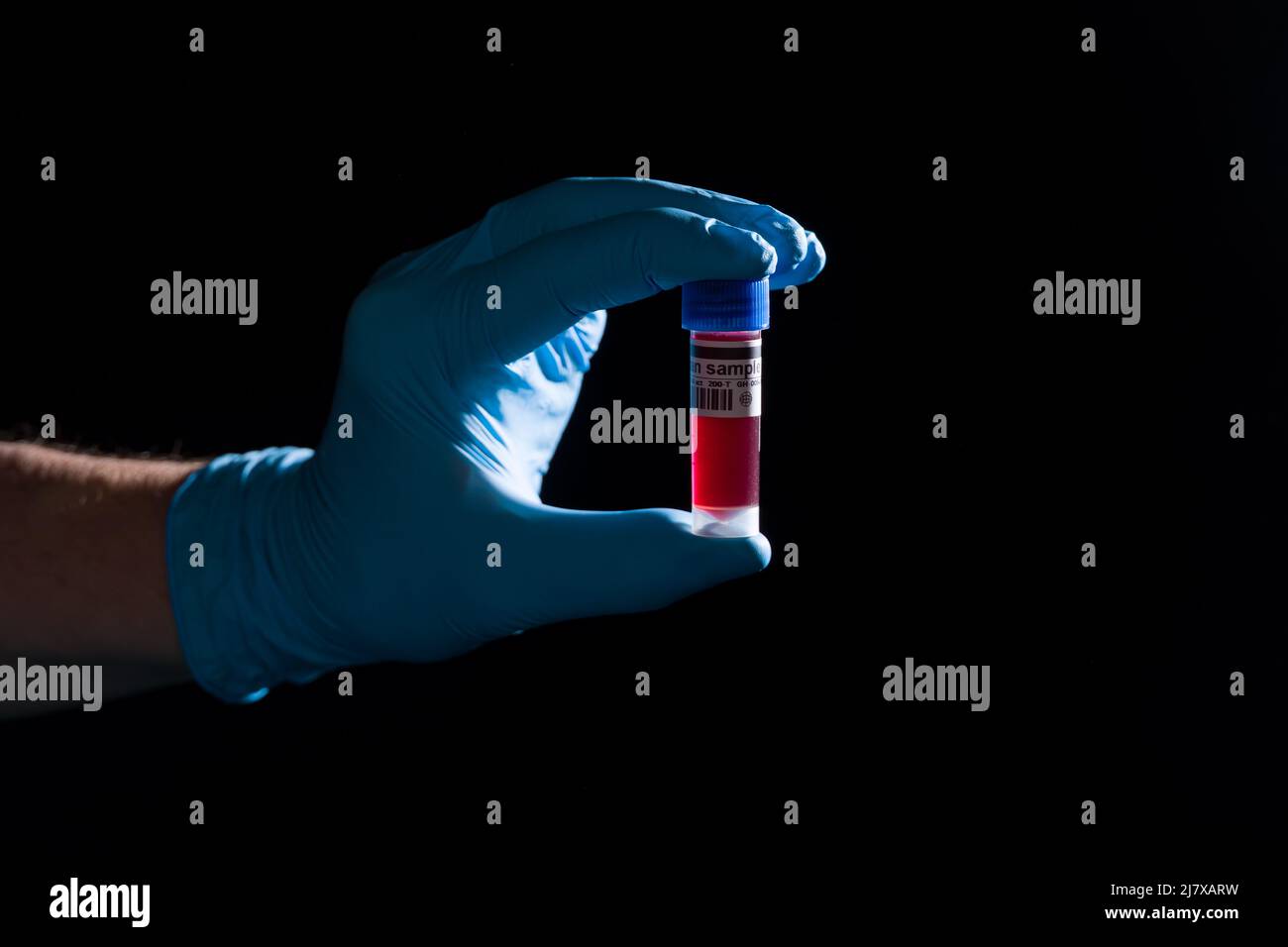 Close-up of doctor's hand wearing medical gloves holding a blood probe ...