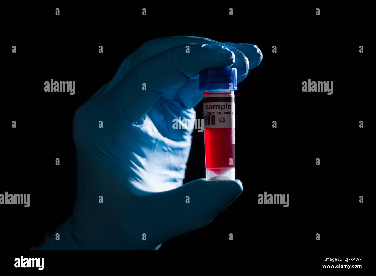 Close-up of doctor's hand wearing medical gloves holding a blood probe ...