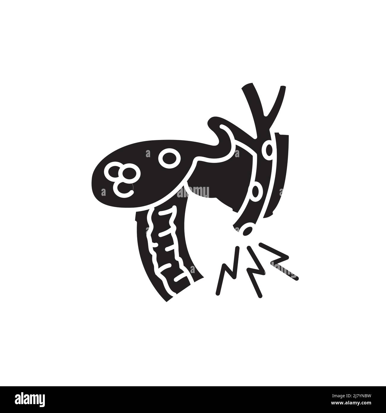 Chronic cholecystitis color line icon. Human diseases. Pictogram for ...