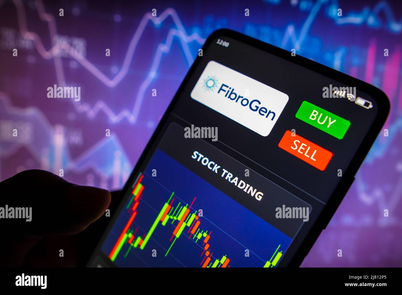 In this photo illustration the stock trading graph of FibroGen seen on ...