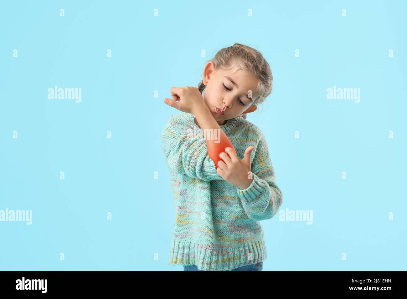 Little girl with allergy scratching herself on light blue background ...