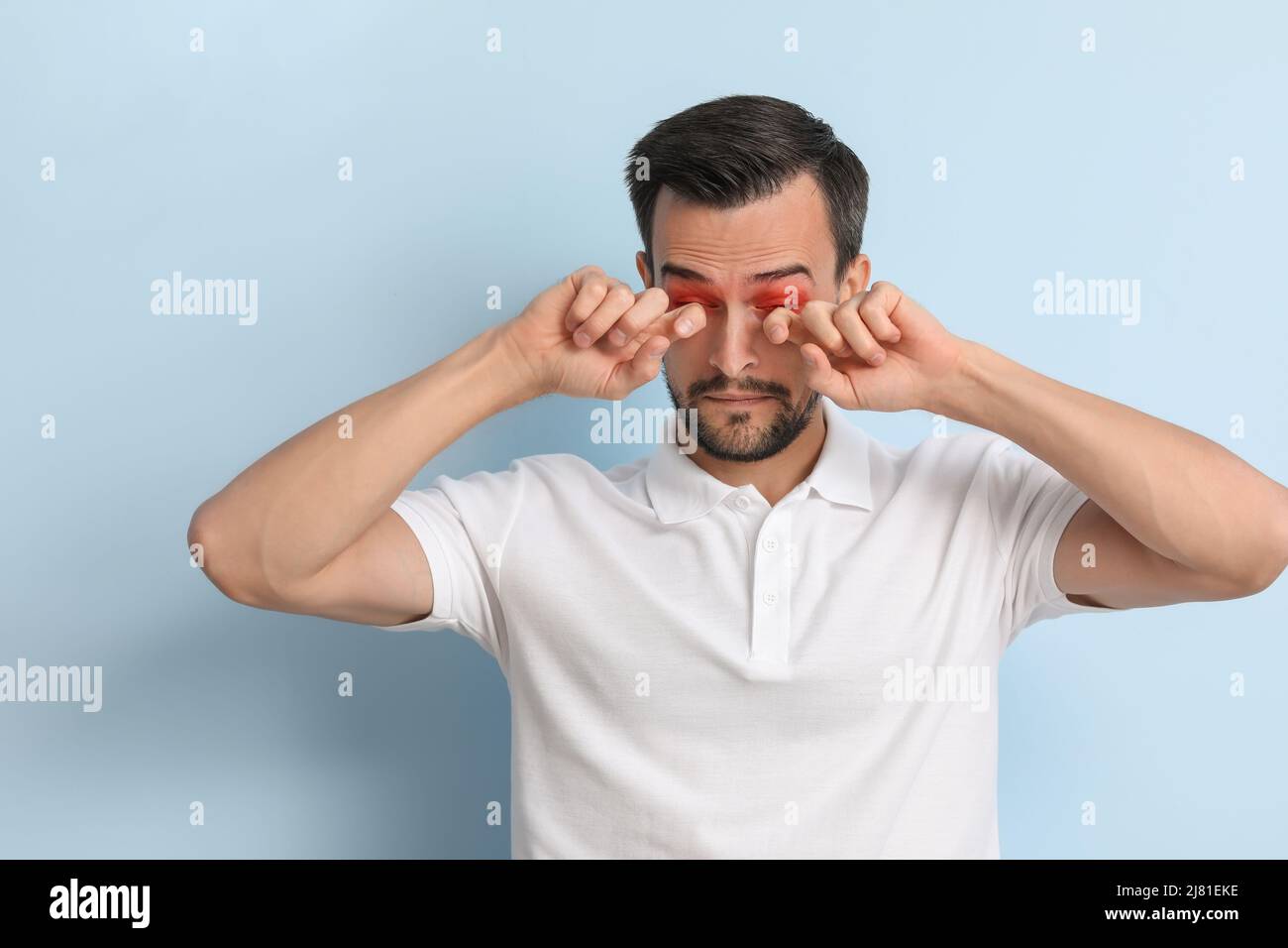 Man with red eyes on light blue background. Allergy concept Stock Photo ...