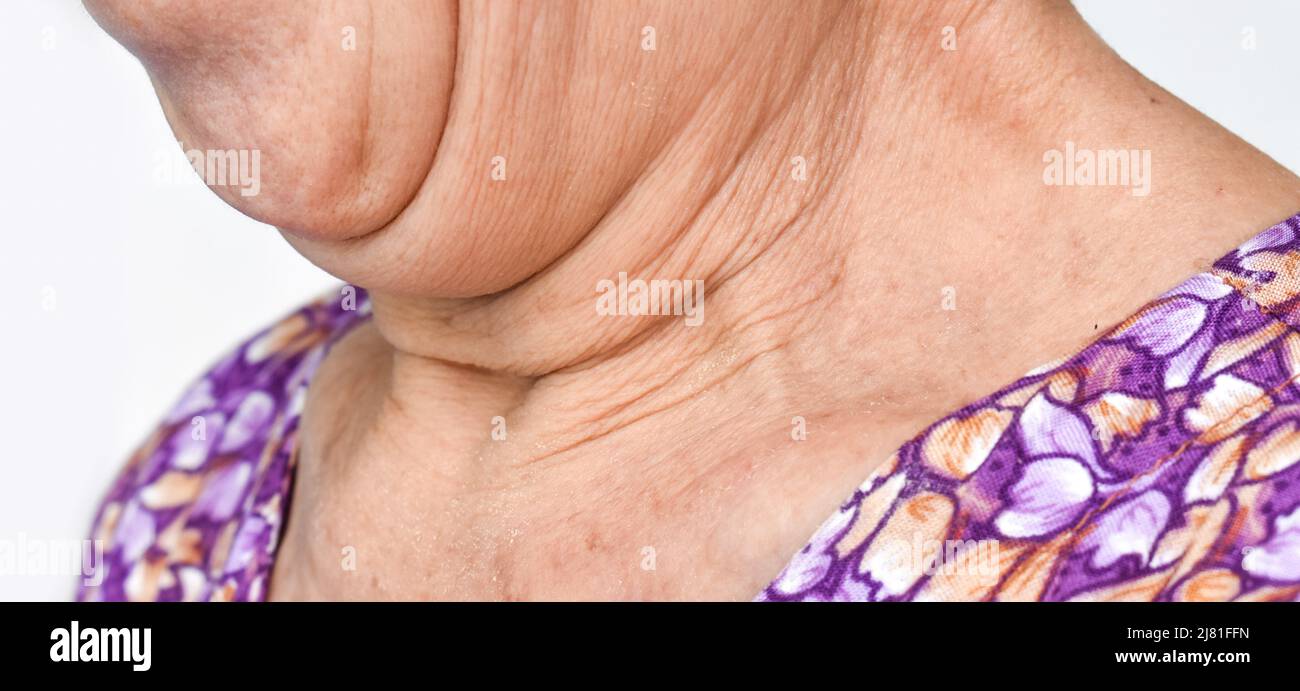 Old fat woman hi-res stock photography and images - Alamy