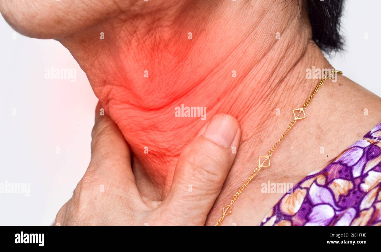 Swelling female neck hi-res stock photography and images - Alamy