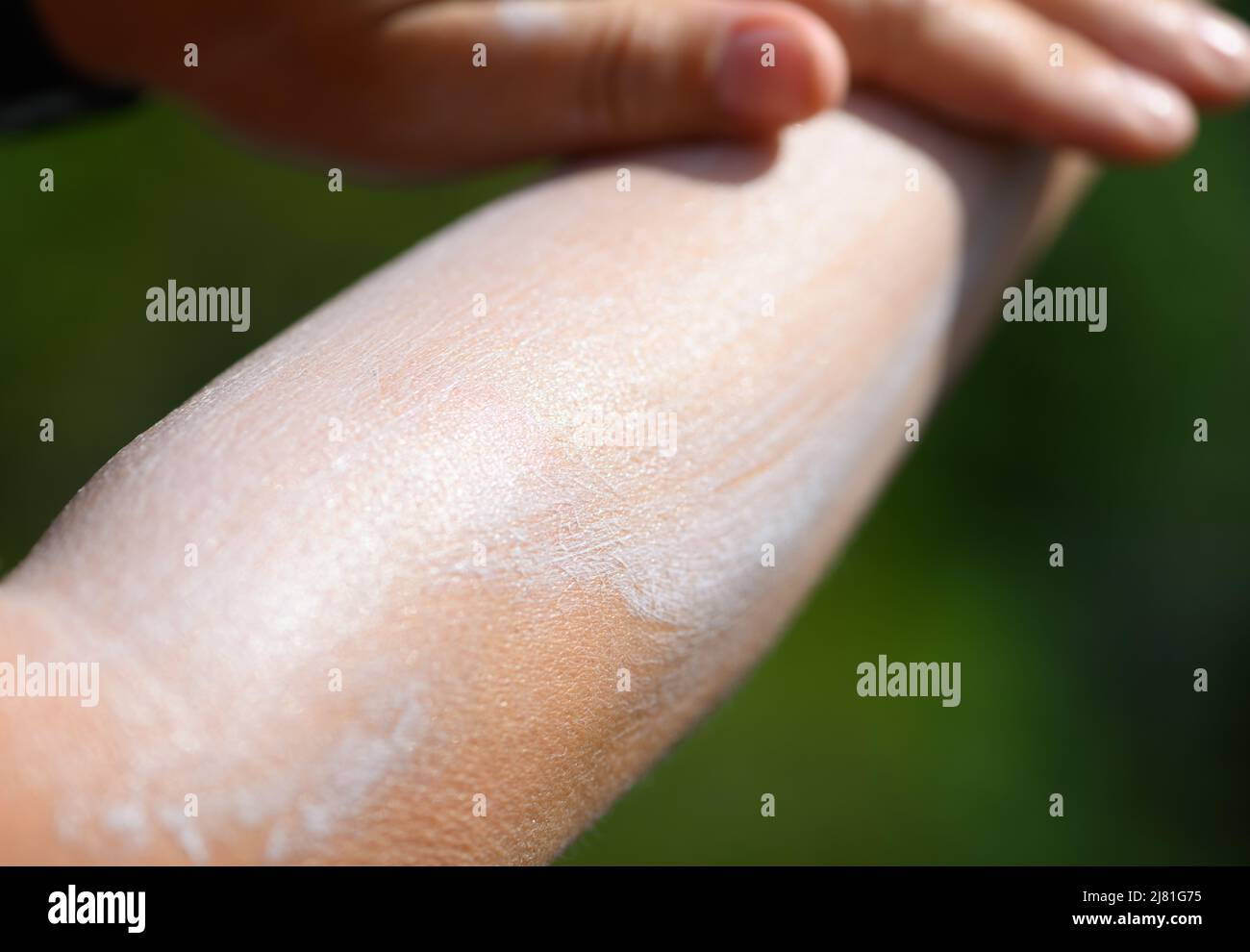 Dresden, Germany. 06th May, 2022. ILLUSTRATION - A woman puts sunscreen ...