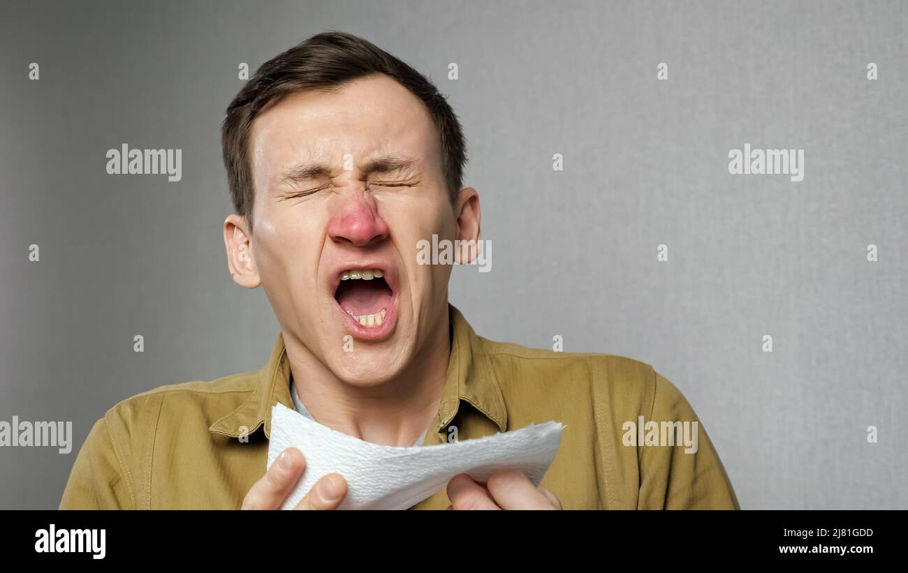 Man red nose sneezes suffering hi-res stock photography and images - Alamy