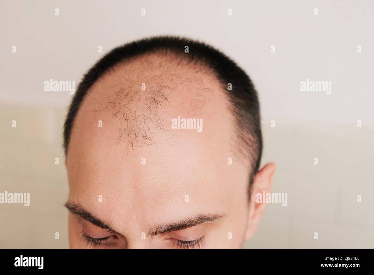 Man bald at the temples hi-res stock photography and images - Alamy