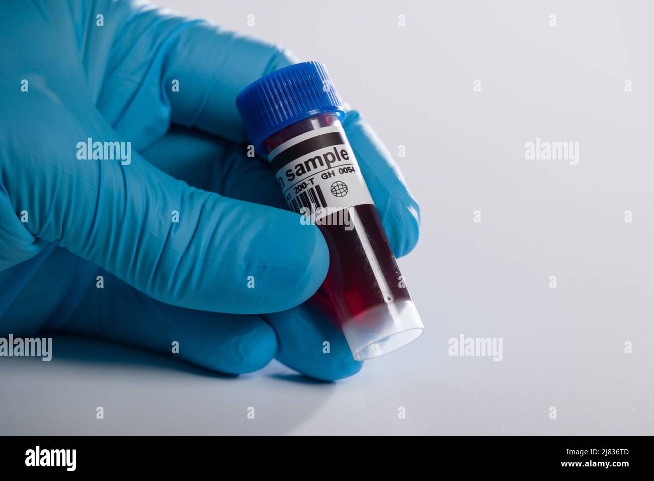 close-up of a hand in medical gloves handling a blood probe with coded ...