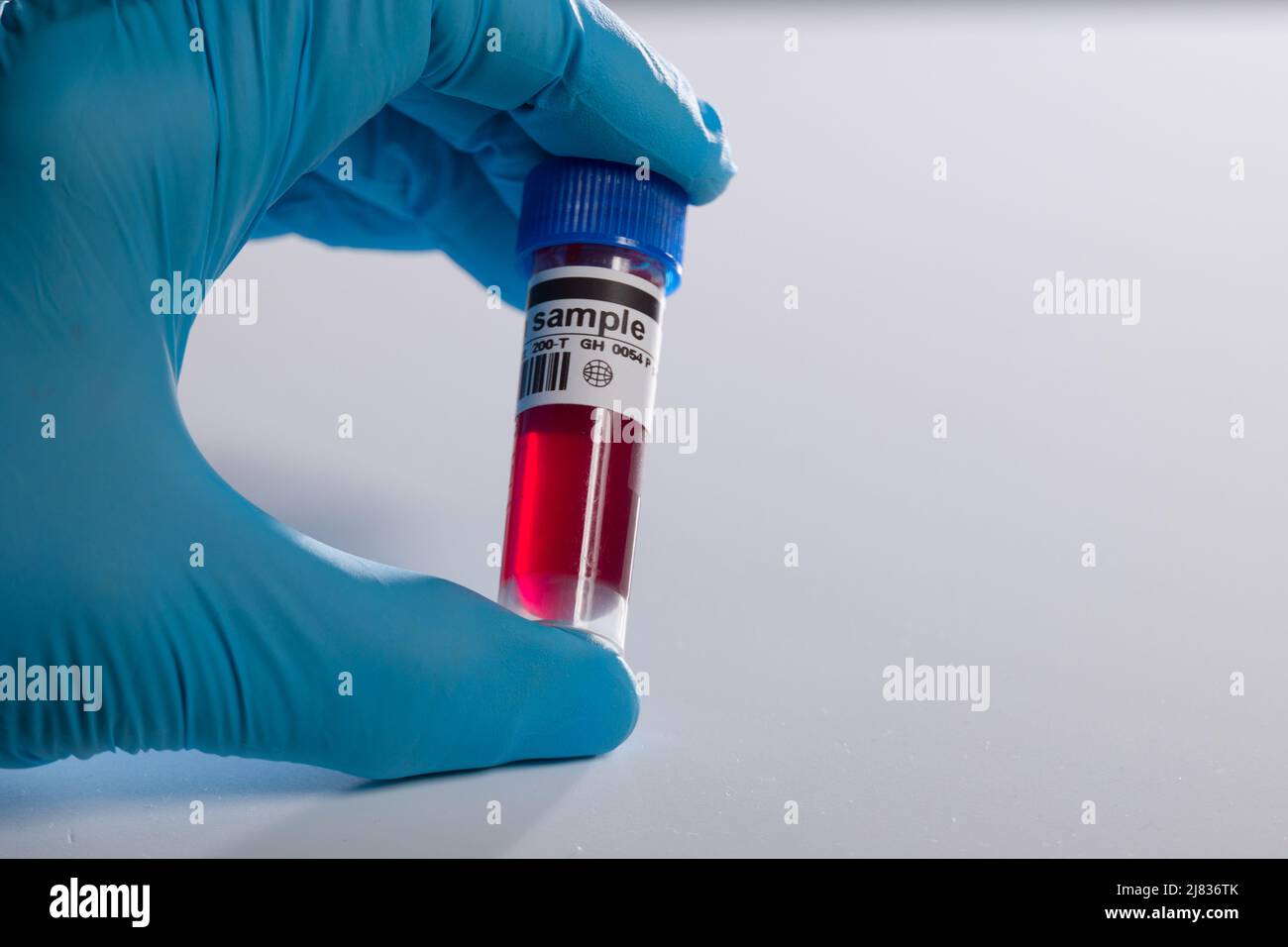 close-up of a hand in medical gloves handling a blood probe with coded ...
