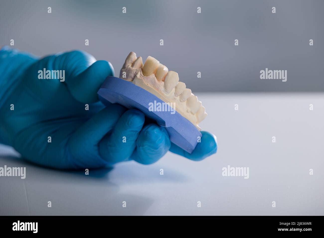 Close-up of artificial dentition on a dental imprint ready to use Stock ...