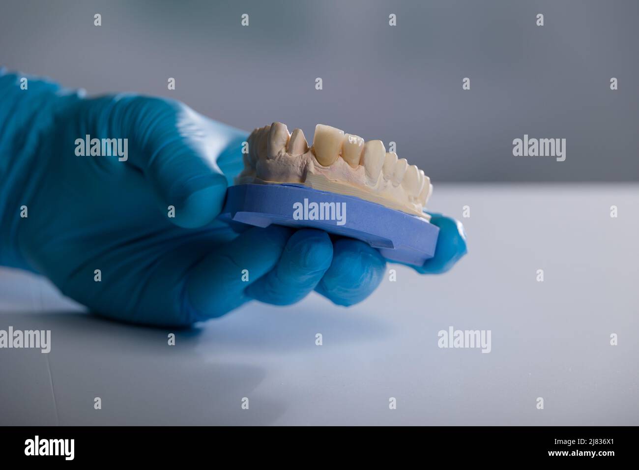 Close-up of artificial dentition on a dental imprint ready to use Stock ...