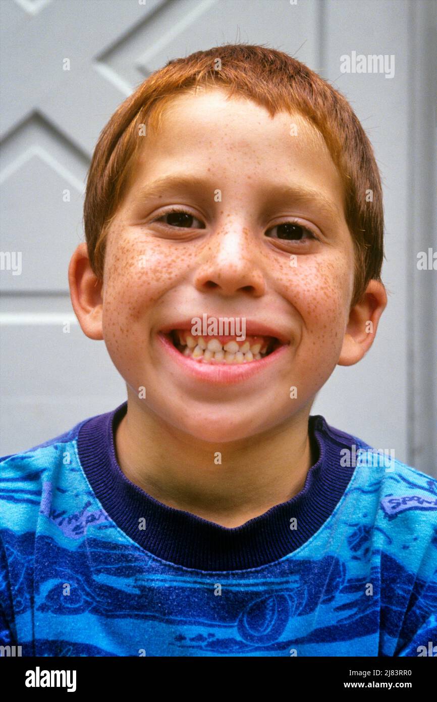 1990s PORTRAIT OF RED HAIRED BOY FRECKLES AND BIG GRIN SMILE LOOKING AT ...