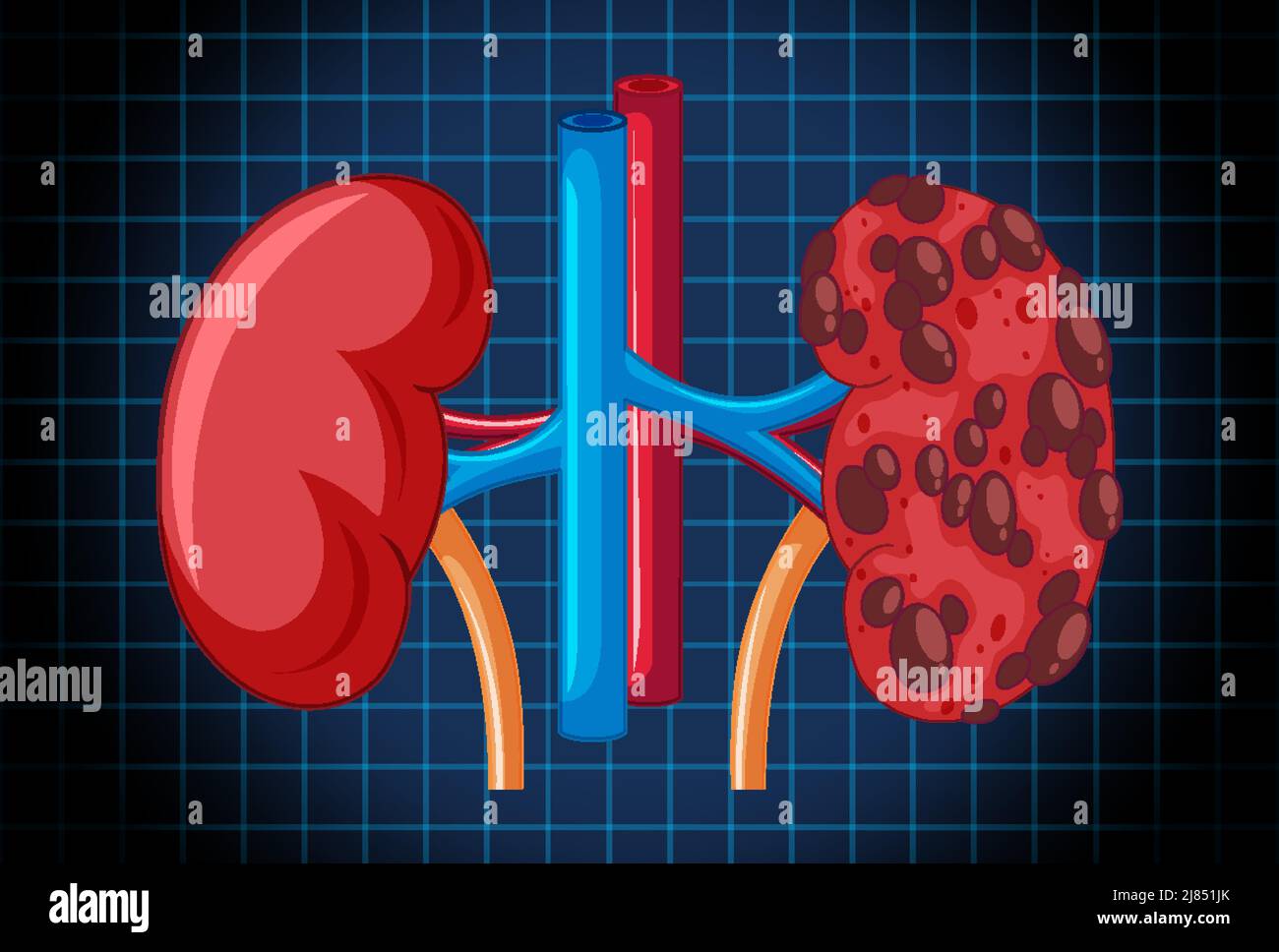 Human internal organ with kidneys illustration Stock Vector Image & Art ...