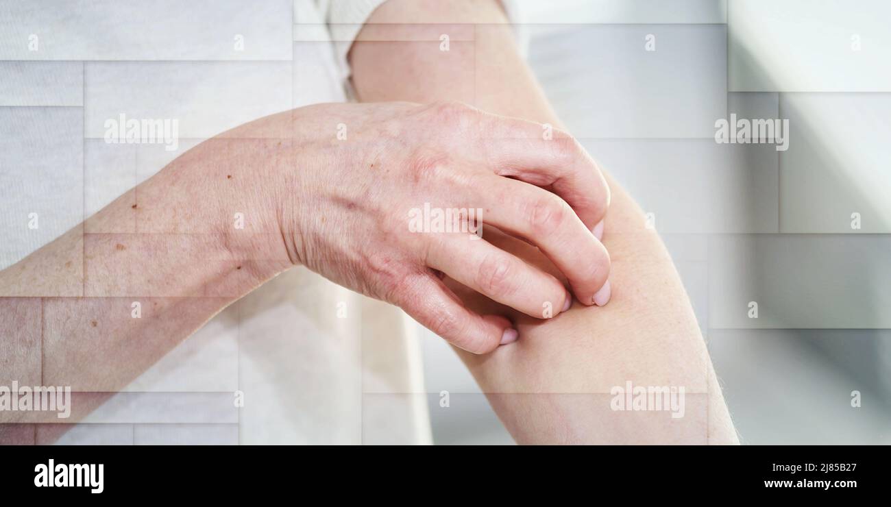 Woman having itchy and scratching her arm. allergy symptoms, geometric pattern Stock Photo - Alamy