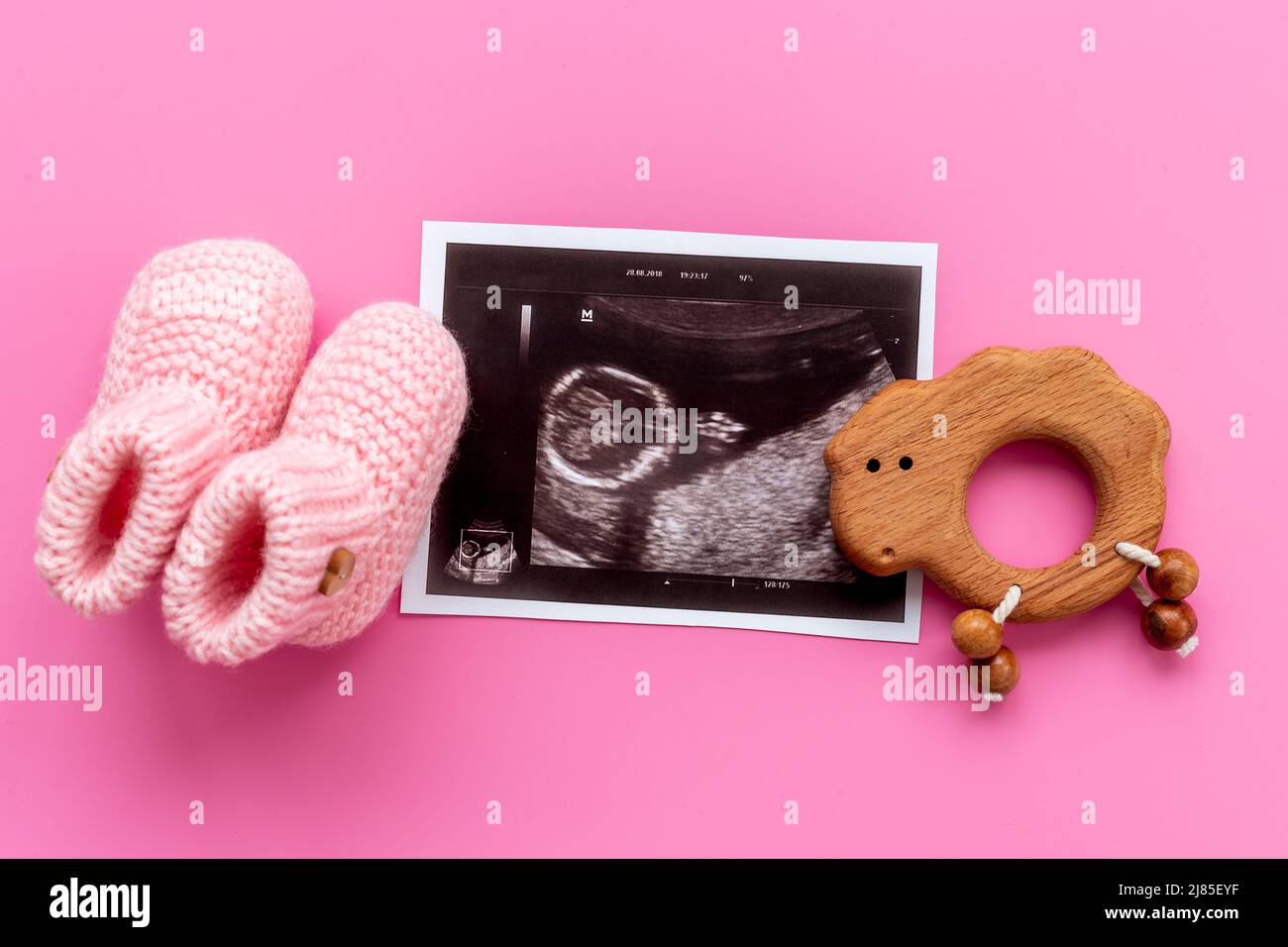 Pregnancy background. Baby accessories with ultrasound picture of ...
