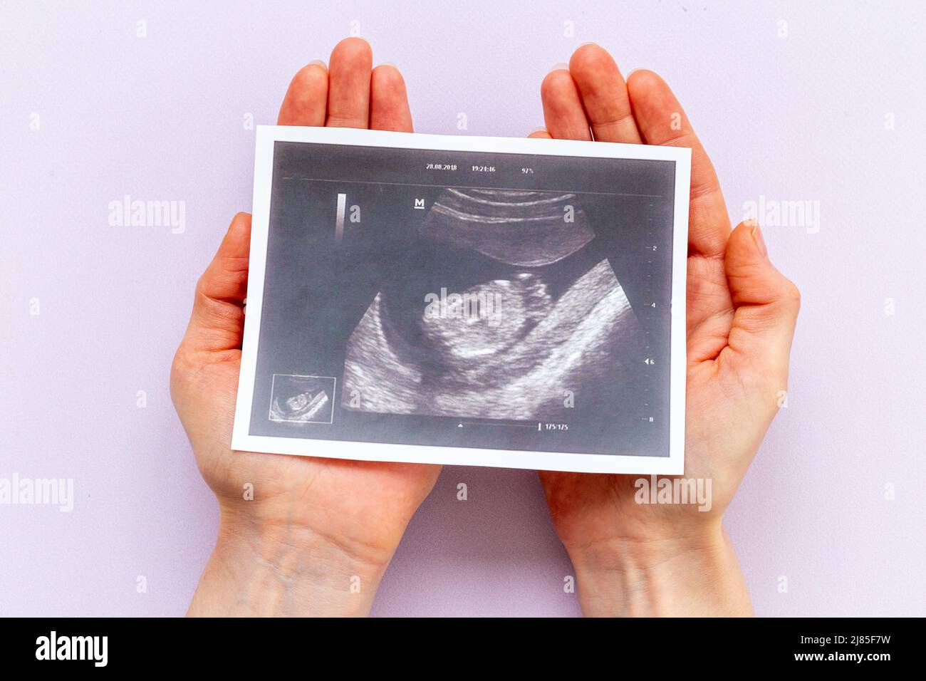 Womans hands holding ultrasound scan of unborn baby. Pregnancy ...
