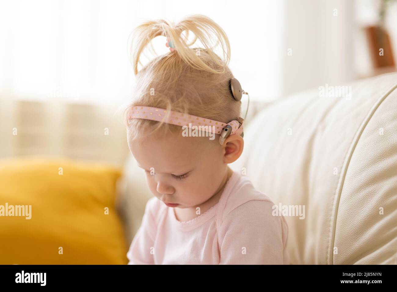 Baby with cochlear implants at home. Deafness and medical technology ...