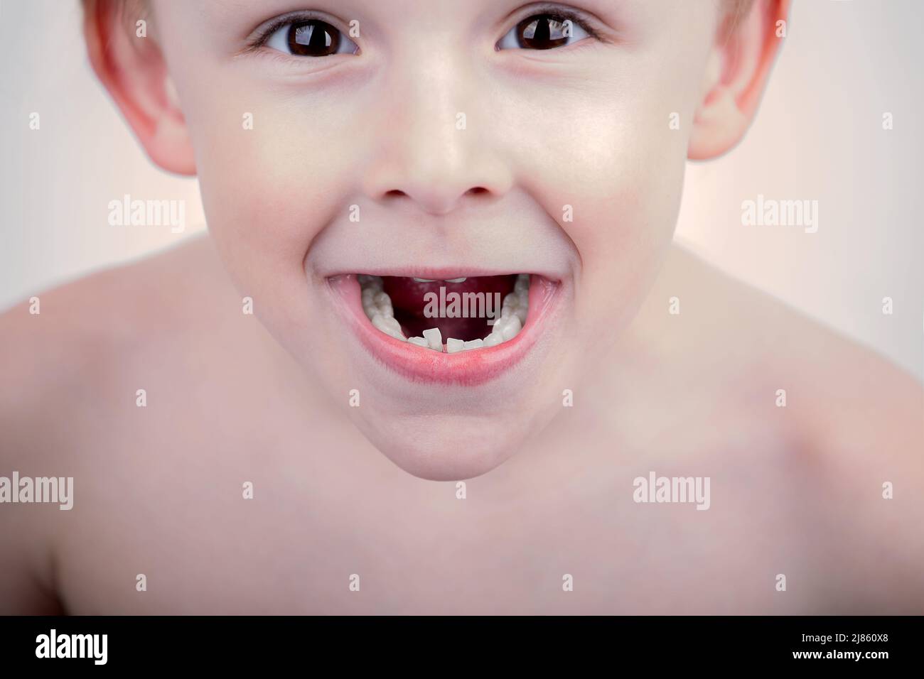 The first baby tooth, ready to fall out Stock Photo - Alamy
