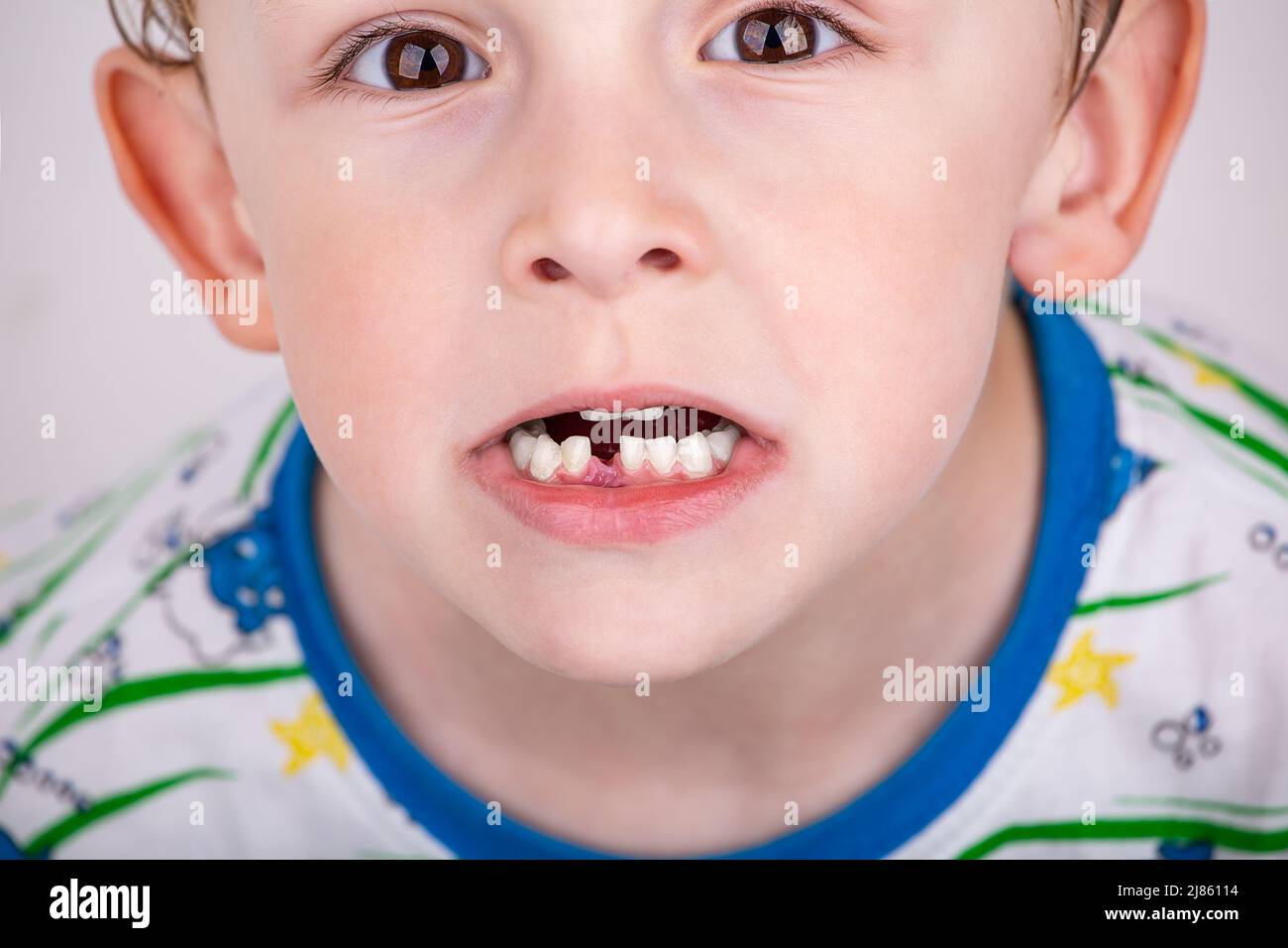 Baby tooth hi-res stock photography and images - Alamy