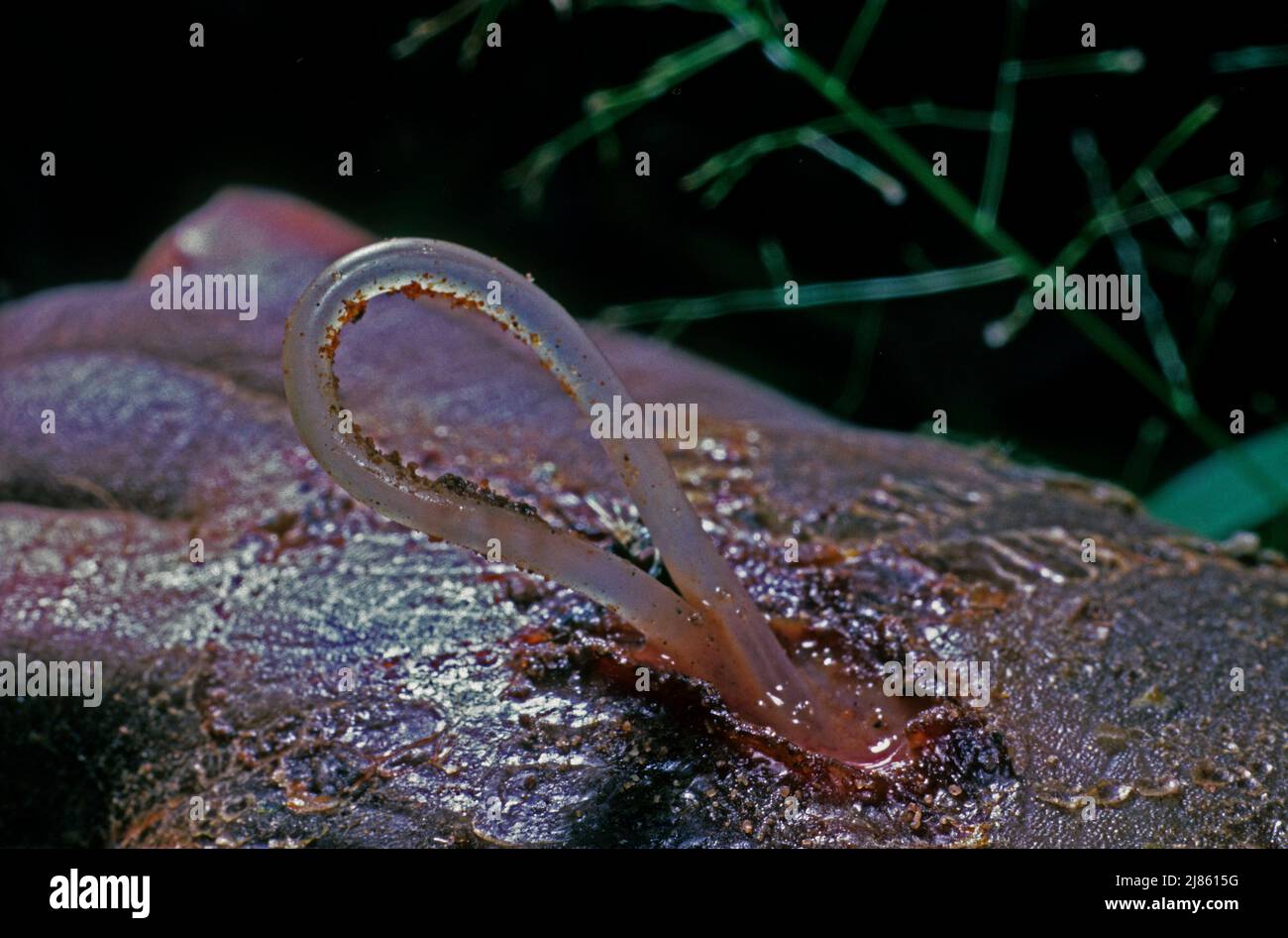 Guinea worm emerging from an ulcerated skin Benin Stock Photo - Alamy