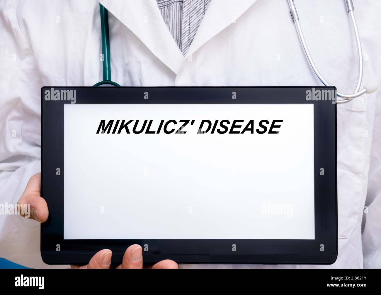 Mikulicz' Disease. Doctor with rare or orphan disease text on tablet ...