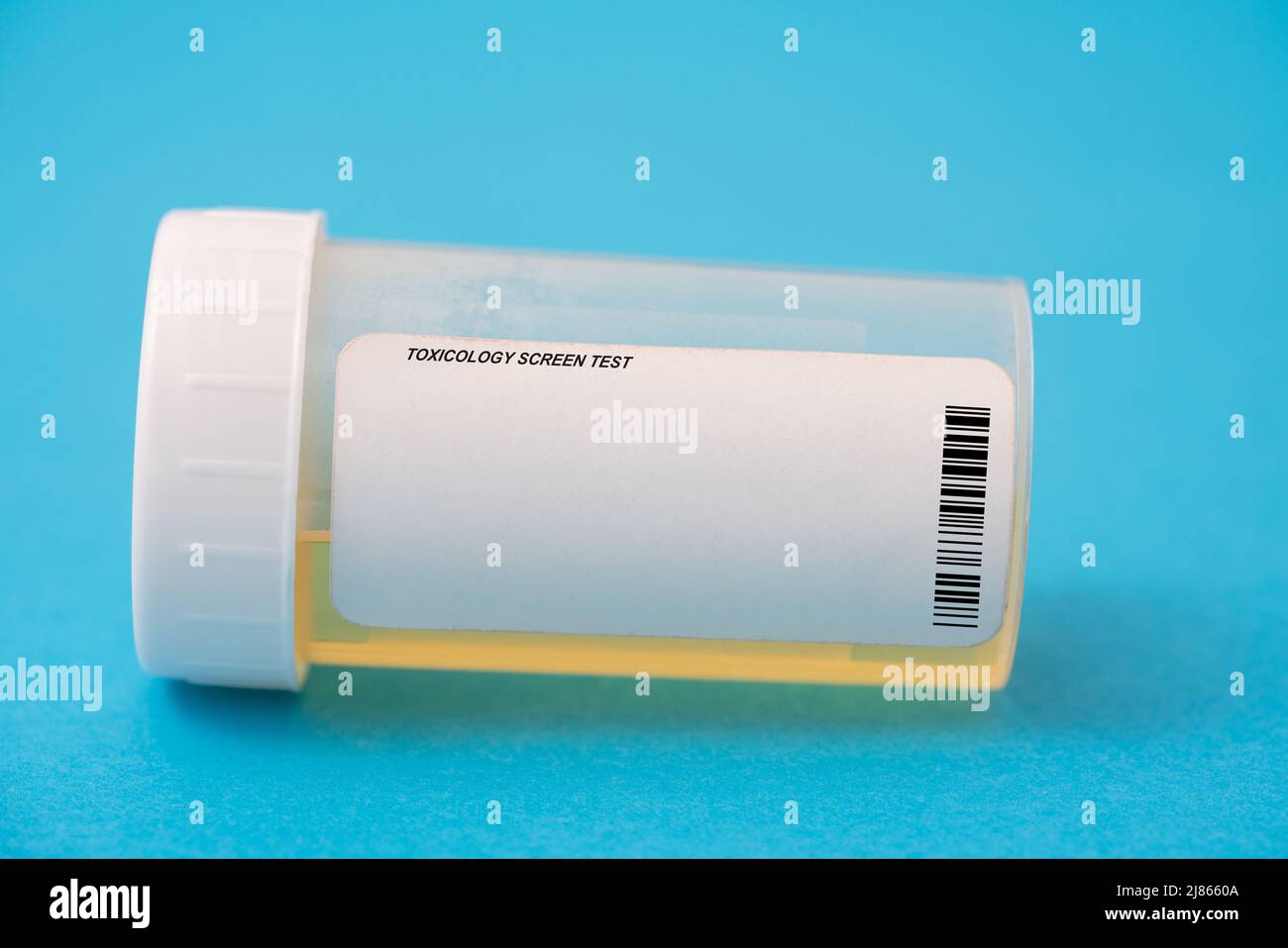 container with a urine sample for laboratory analysis Stock Photo - Alamy