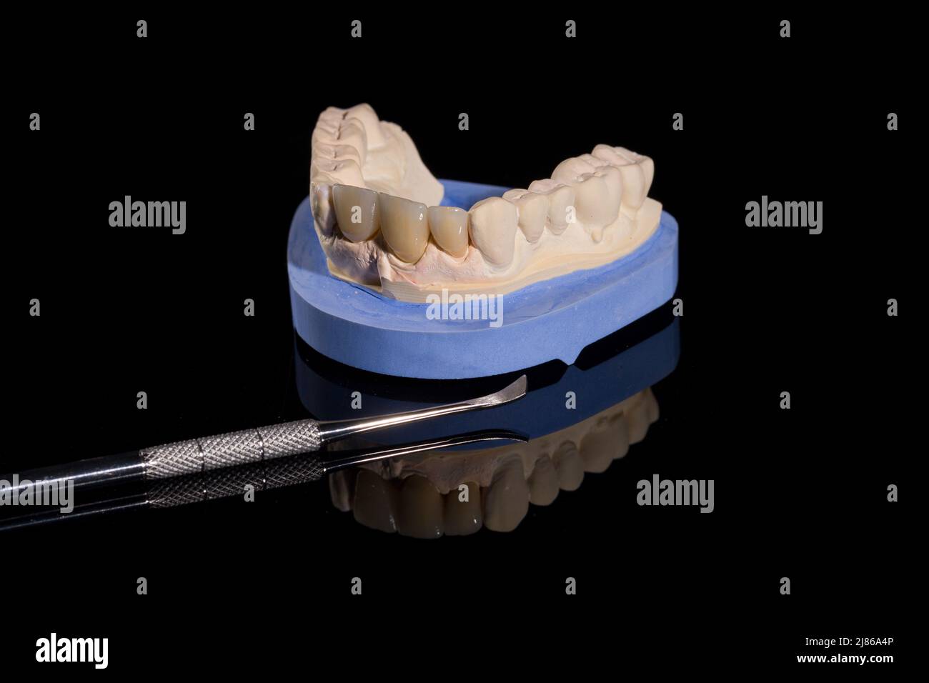 Dental imprint with artificial dentition produced in a dental ...