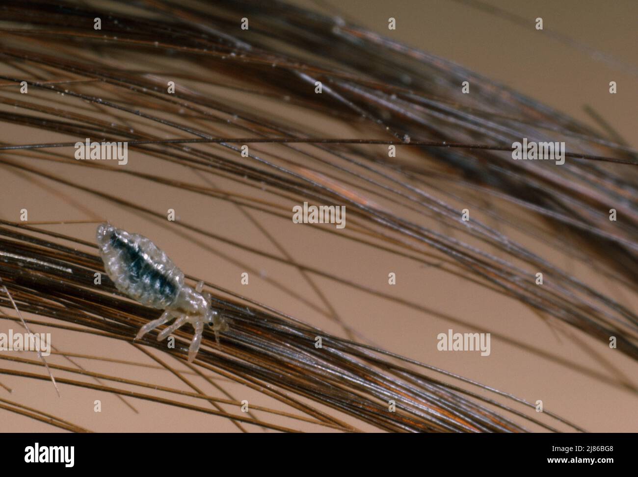 Head Louse on hair Stock Photo - Alamy