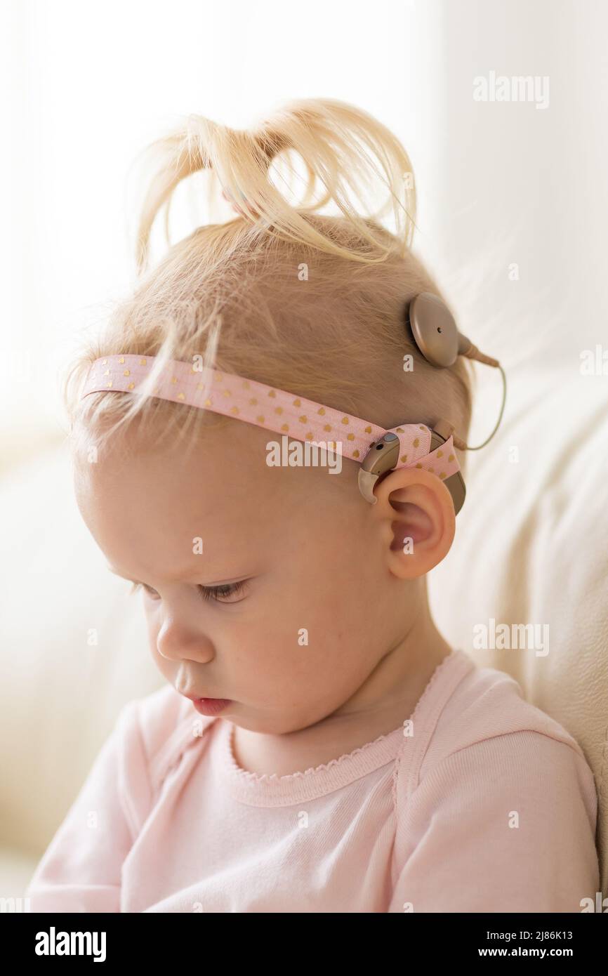 Baby with cochlear implants at home. Deafness and medical technology ...