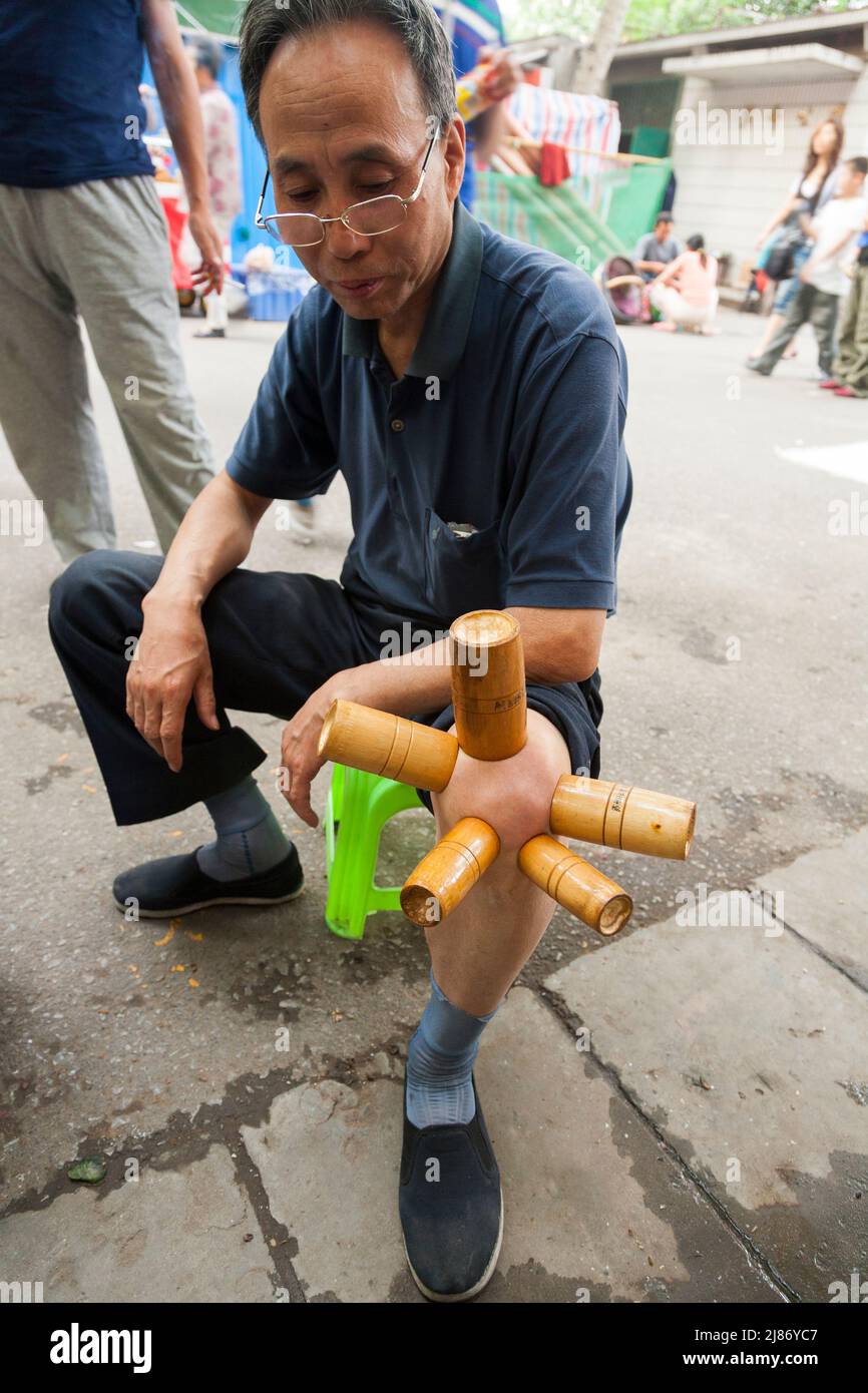 Using cupping therapy ( vacuum suction low pressure treatment ) to ...