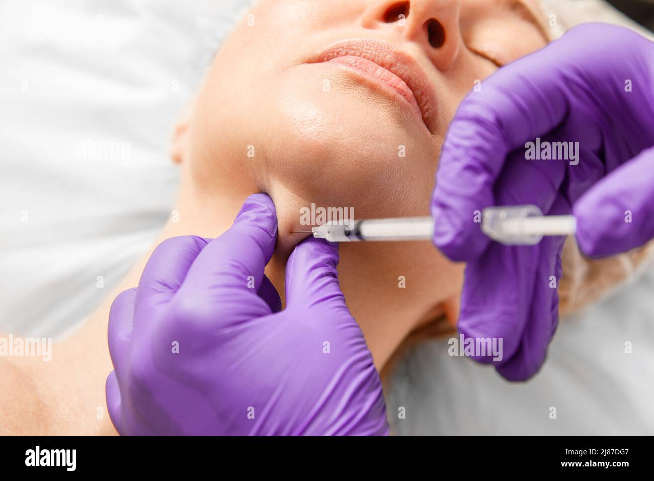 Cosmetologist performs the chin lift procedure by injecting beauty ...