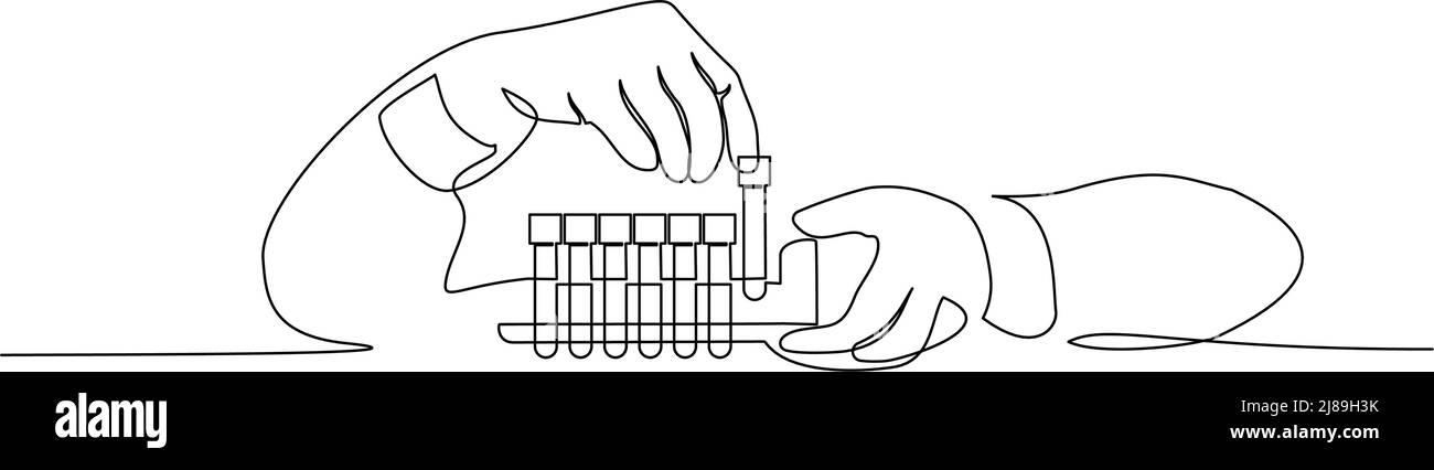 Medical staff analyze coronavirus tests. Medical test for COVID-19 ...
